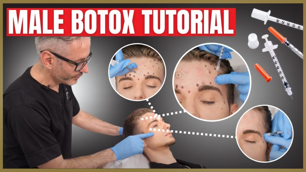 Botox Tutorial For Men | Botox Injection Patterns | Forehead ...